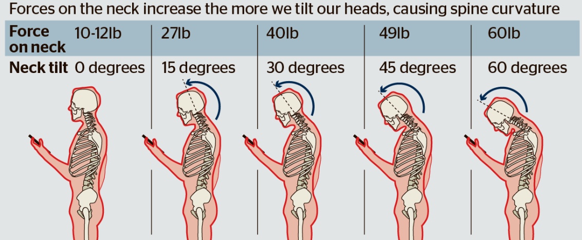 Body Awareness: Forward Head Posture | Asheville Salt Cave
